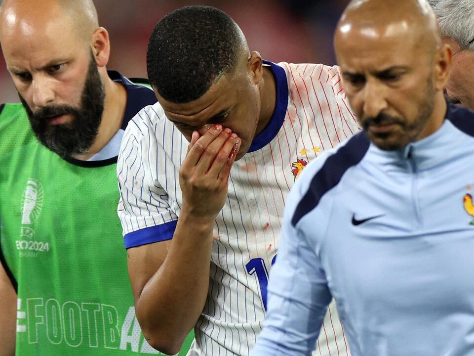 Kylian Mbappe's nose takes center stage at Euros and Lionel Messi ...