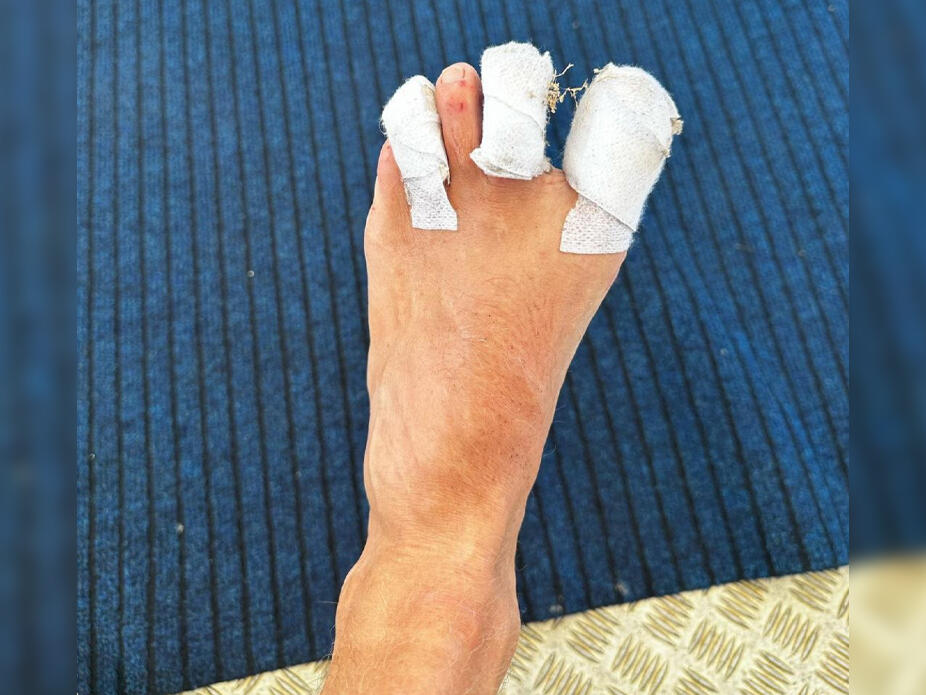Colin Jost Maimed His Foot at Teahupo’o: An Ongoing Saga
