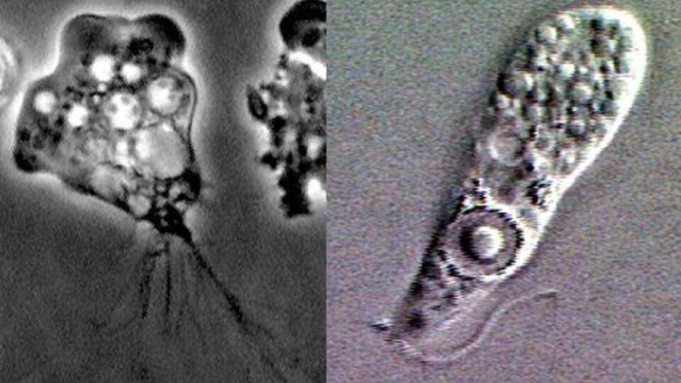 Brain eating amoeba-infected patient dies, Missouri health officials ...