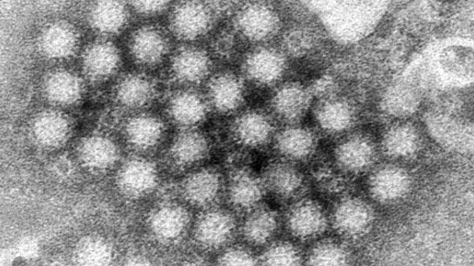 CDC data shows surge in norovirus cases in parts of the US - NewsBreak