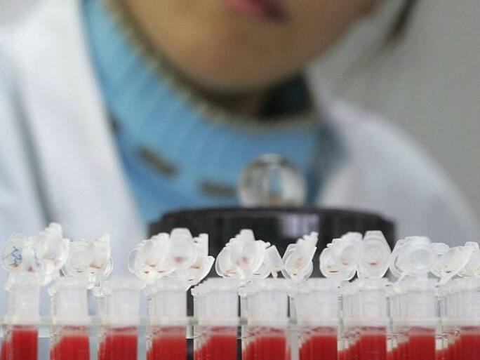 FACT CHECK: Were Over 40,000 People In Houston, Texas Diagnosed With An ...