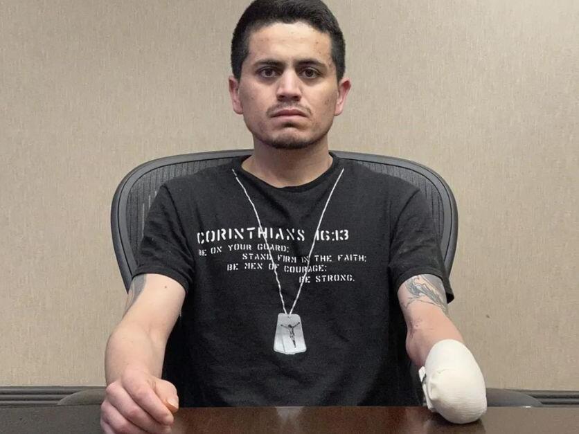 ‘I have no words for it’: Man handcuffed by police for so long his hand ...