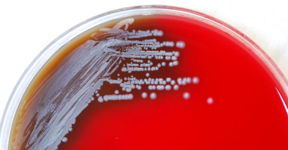 Infections In Mississippi Are First Signs That A Type Of Deadly ...