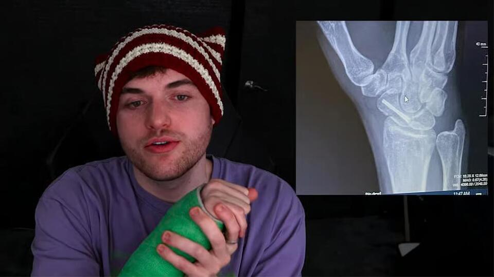 Dream “scared” for Minecraft career after breaking wrist in sparring ...
