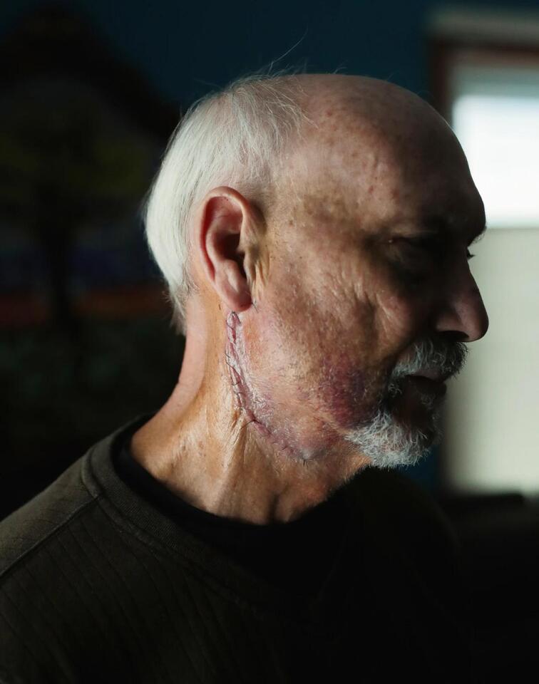 Broken bones, burning eyes: How Trump's DHS deploys 'less lethal ...