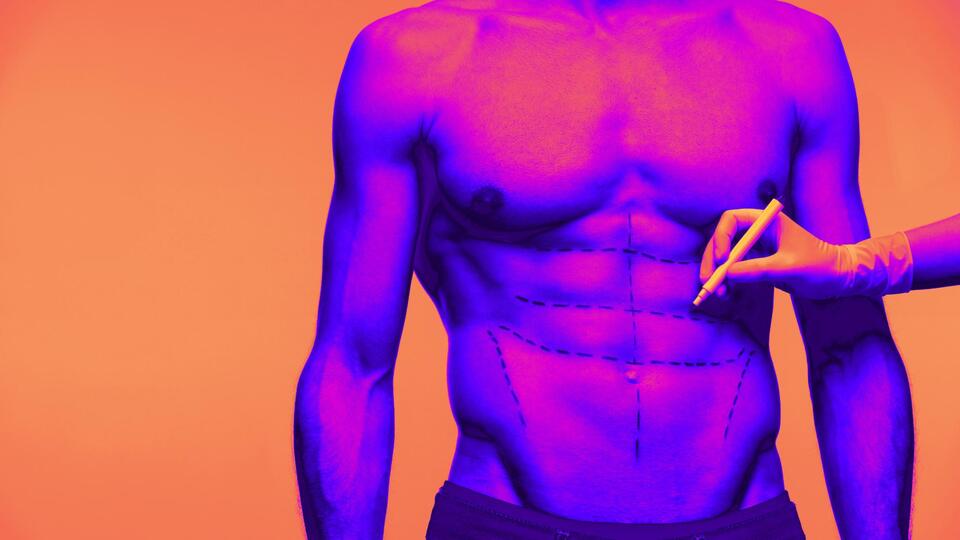 Man Injects Himself With $560,000 Worth of Fillers for Fake 8-Pack Abs ...