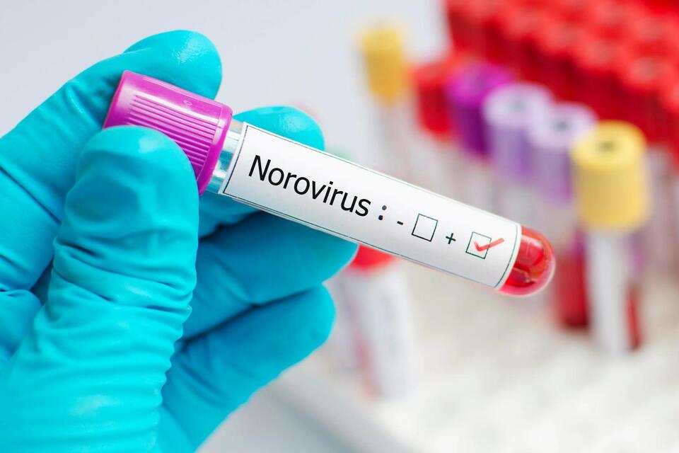 New strain of norovirus could be driving outbreaks, Wisconsin health ... New strain of norovirus could be driving outbreaks, Wisconsin health ...