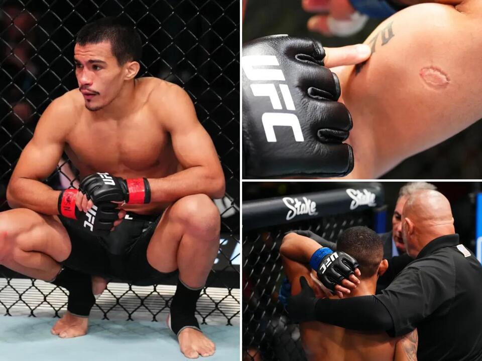 Igor Severino disqualified and then released by UFC after biting opponent