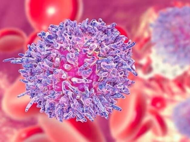 Treatments for lymphoma have advanced beyond chemotherapy