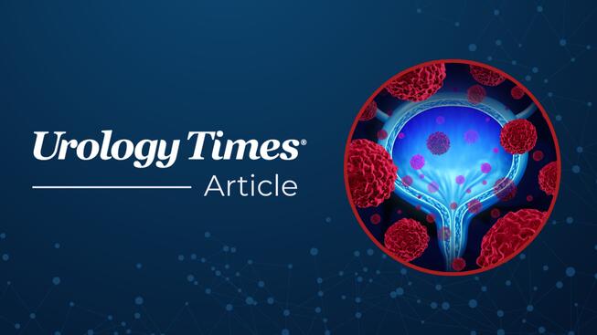 CMS issues permanent J-code to gemcitabine intravesical system - NewsBreak