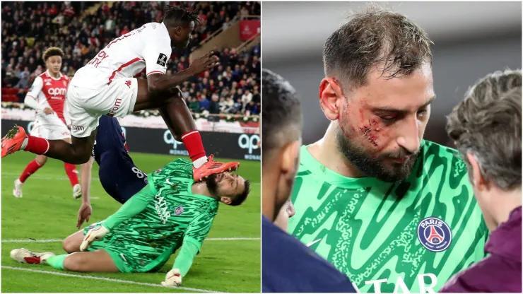PSG’s Gianluigi Donnarumma suffers brutal face injury that sparks ...