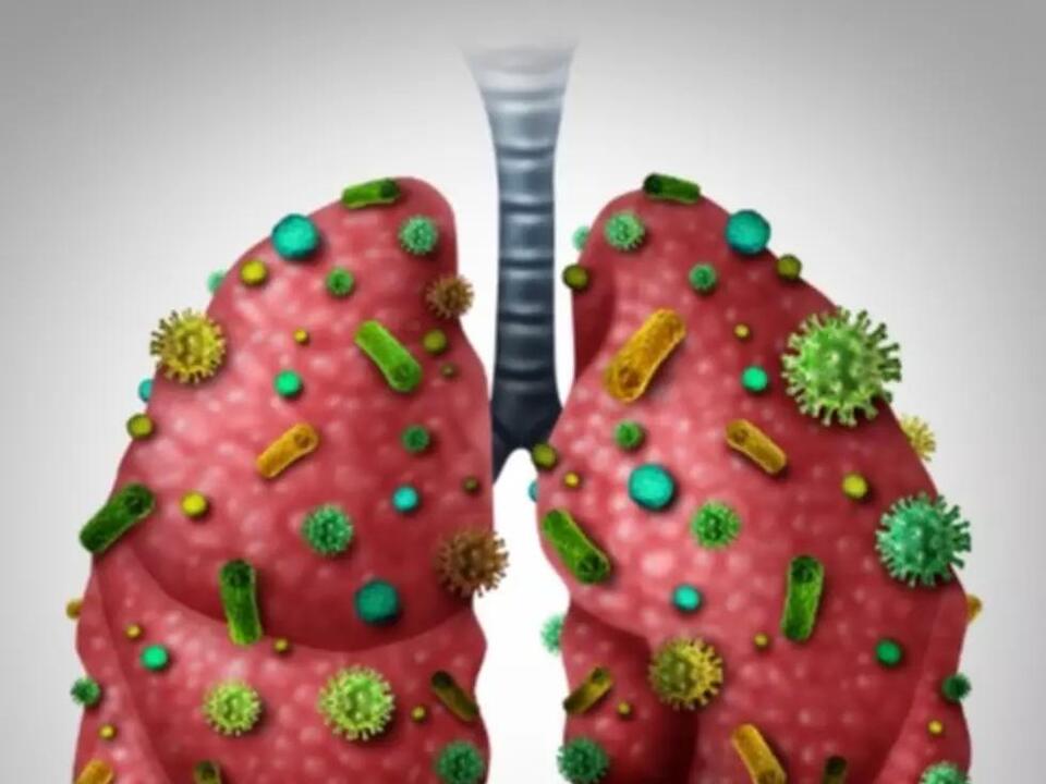 Walking Pneumonia Increasing In New York, Symptoms To Watch