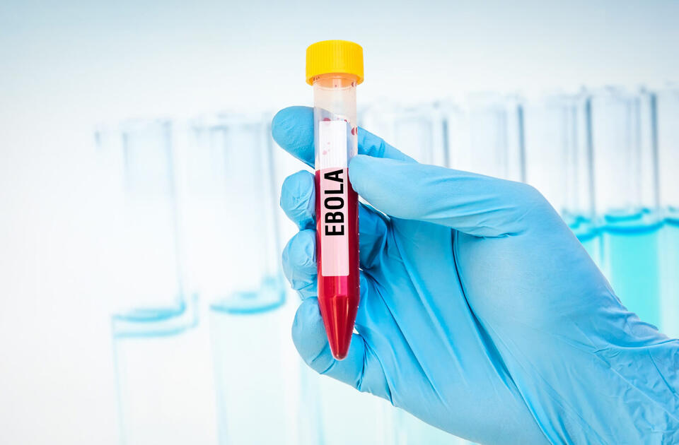 5 Ways Type A Blood Could Be Quietly Raising Your Risk of Early Stroke ...