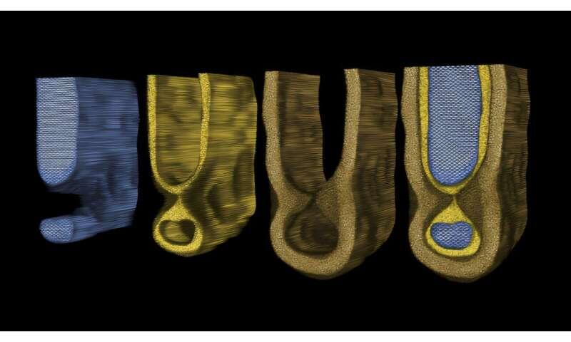 Electron microscopy shows 'mouse bite' defects in semiconductors ...