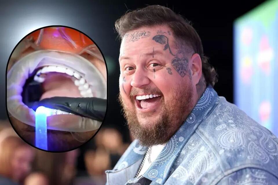 Watch Jelly Roll’s Teeth Transformation — As Seen by His Dentist ...