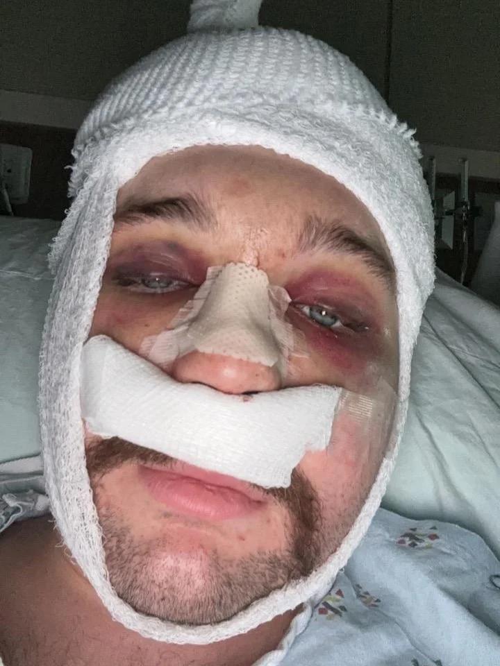 Court records provide more detail in downtown Fargo assault case ...