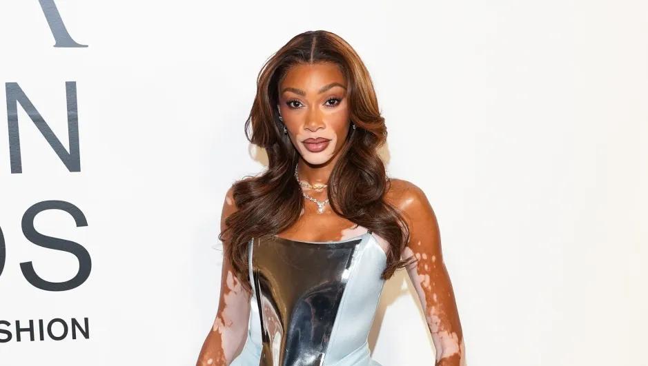 Winnie Harlow’s Net Worth: How Much Money She Makes Now - NewsBreak