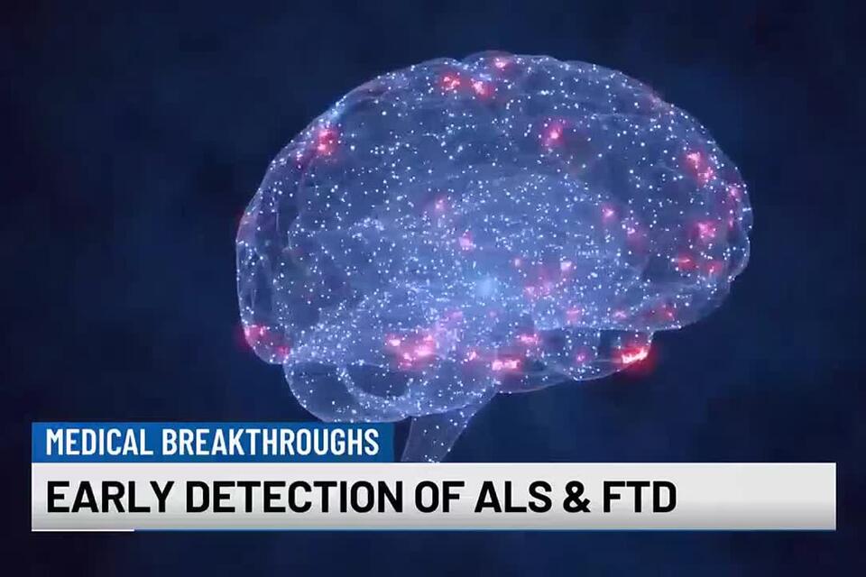 Early Detection of ALS & FTD - NewsBreak