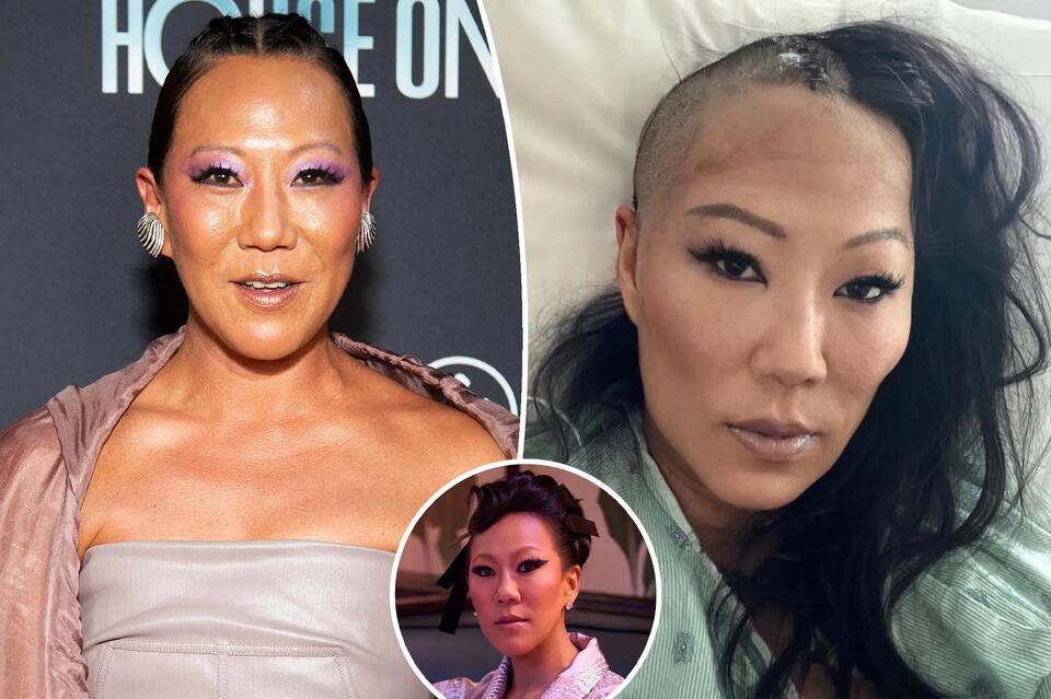 ‘Bling Empire: New York’ star Lynn Ban detailed scary brain bleed weeks ...