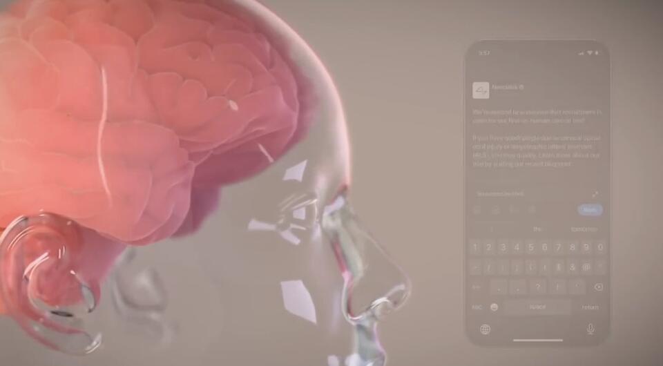 The First Human Has Gotten a Neuralink Implant - NewsBreak