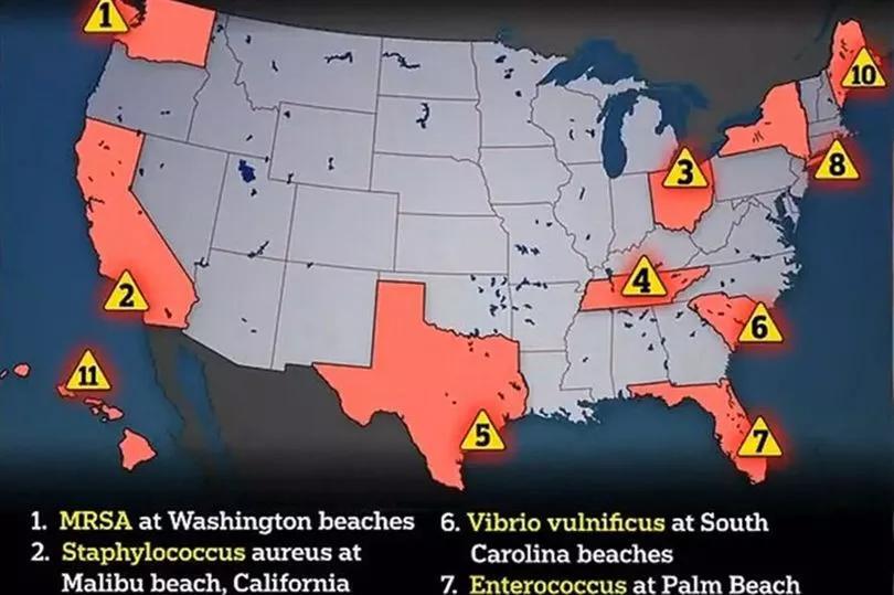 Deadly beaches in the US which could kill you mapped - exactly where ...