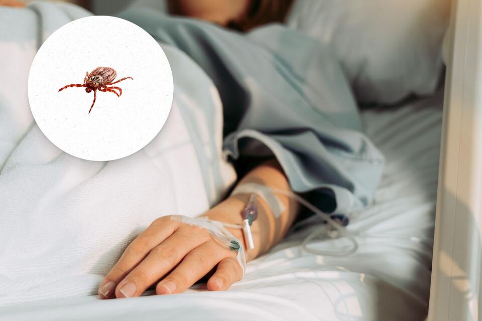 The Alpha-gal Syndrome: Tick-Borne Meat Allergy - NewsBreak