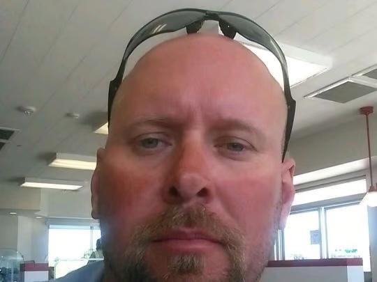 He's Doing Great a Year After World's First Eye and Partial Face Transplant