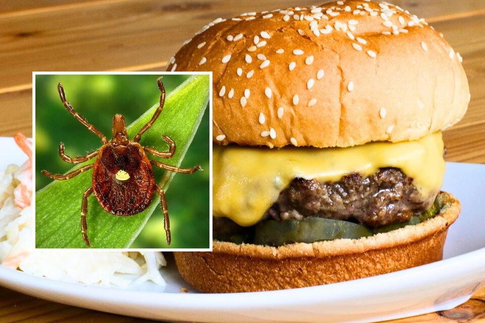 New tickborne meat allergy kills NJ man in first confirmed death ...