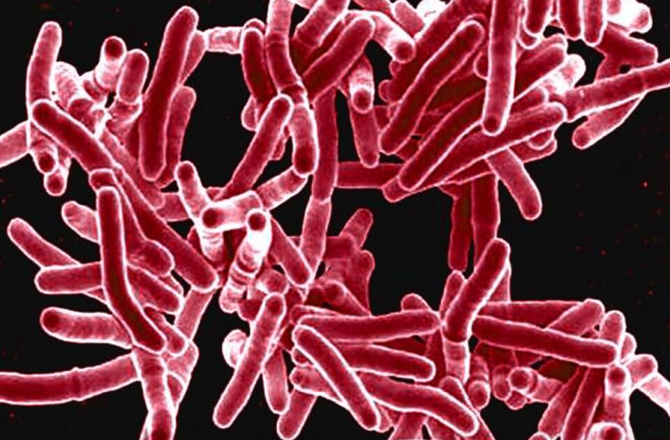 KDHE: Tuberculosis outbreak in Kansas now largest in U.S. history ...