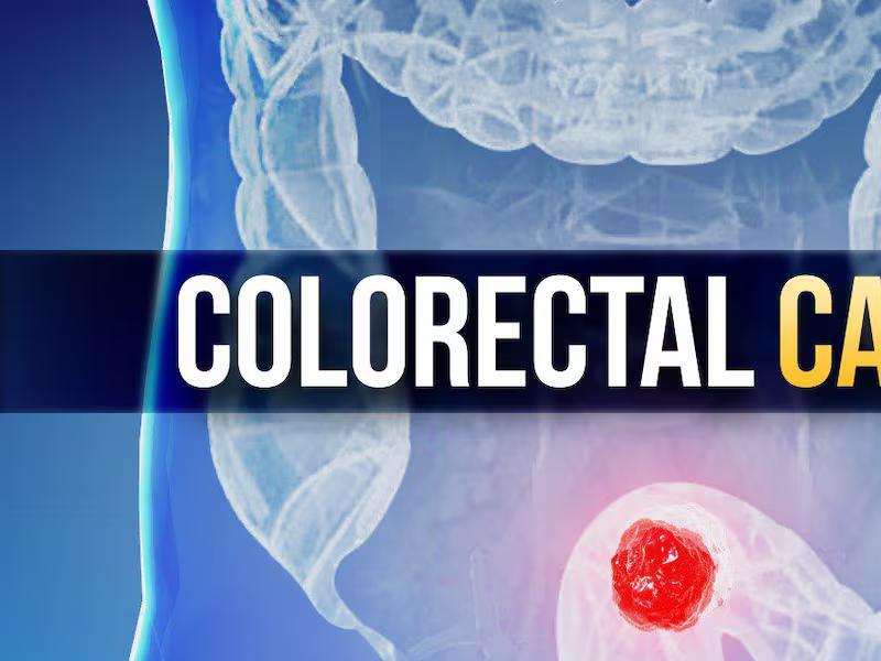 Remembering the importance of colorectal cancer screenings for men
