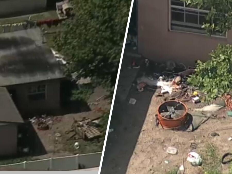 6-year-old boy loses hand after firework explodes at Deerfield Beach home