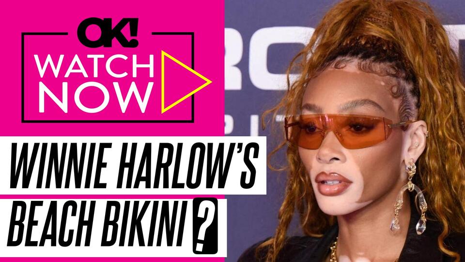 Winnie Harlow Sizzles in Tiny Bikini as She Lounges at the Beach: Hot Photos - NewsBreak