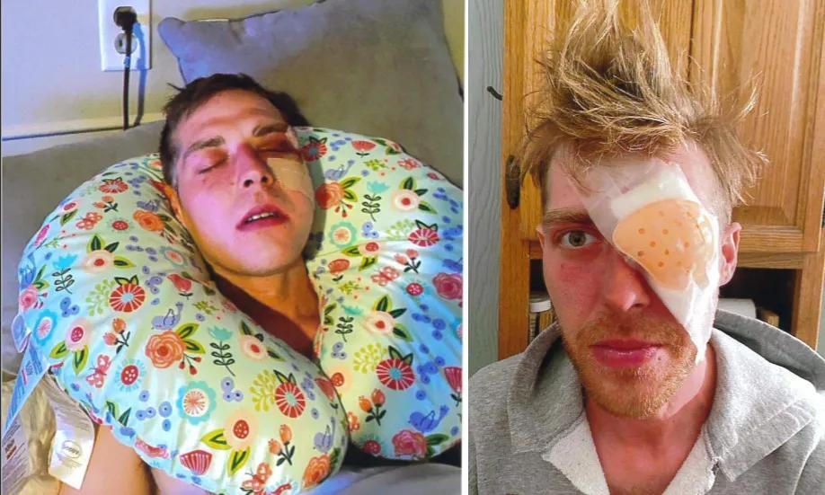 Macomb County man awarded $4 million after punch from cop ruptures his ...