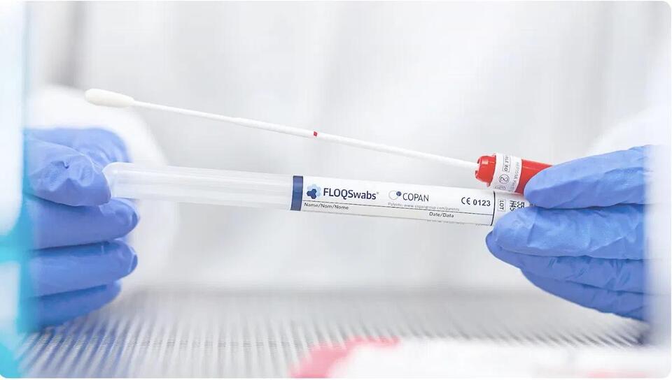 Laboratory expands cervical cancer screening options with new HPV self ...