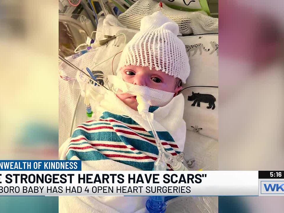 WATCH | Kentucky baby has had 4 open-heart surgeries