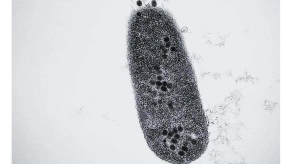 Phage Collection Launched To Fight Drug-Resistant Infections - NewsBreak