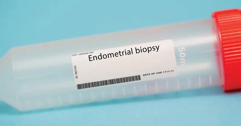 ACOG updates guidance for evaluating postmenopausal bleeding - NewsBreak