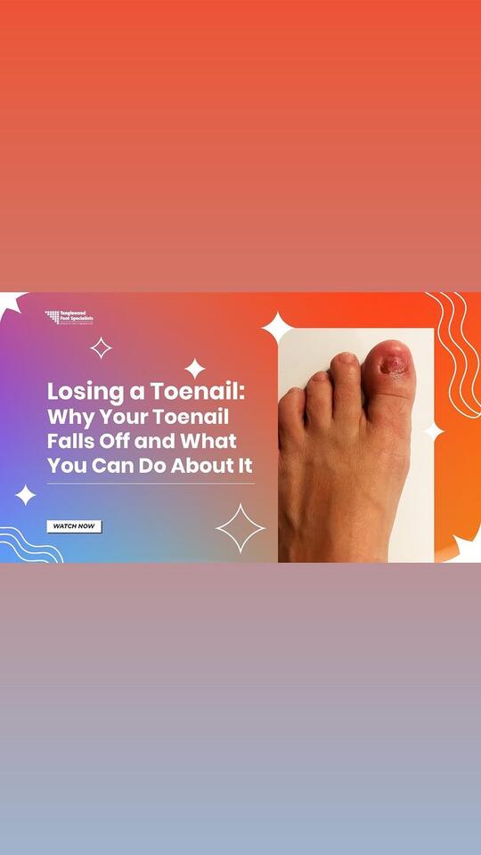 Why Your Toenail Falls Off And What To Do It About It рџ ј Newsbreak