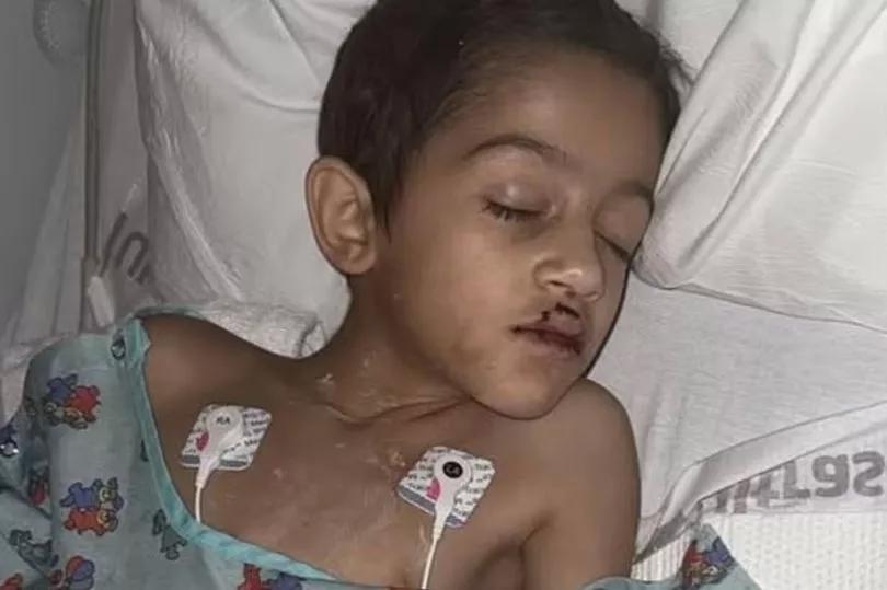 Heart-stopping moment falling drones injure boy during Orlando ...