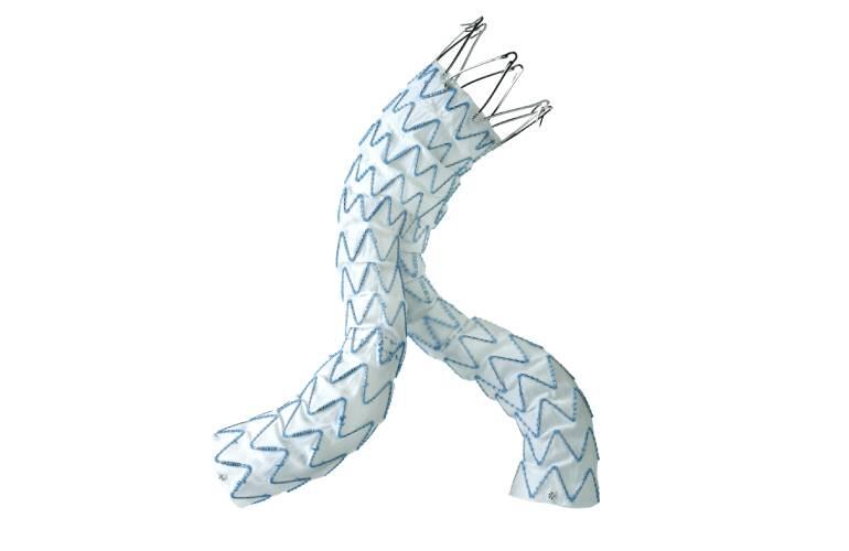 Medtronic says Endurant stent graft’s new CE mark could boost use for ...