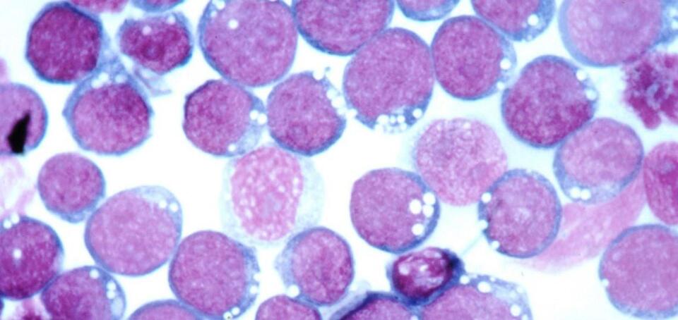 DNA research uncovers 22 genes that could put people at risk of long ...