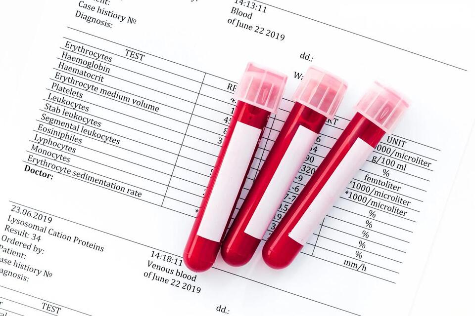 5 Simple Blood Tests That Can Tell You Almost Everything You Need to ...