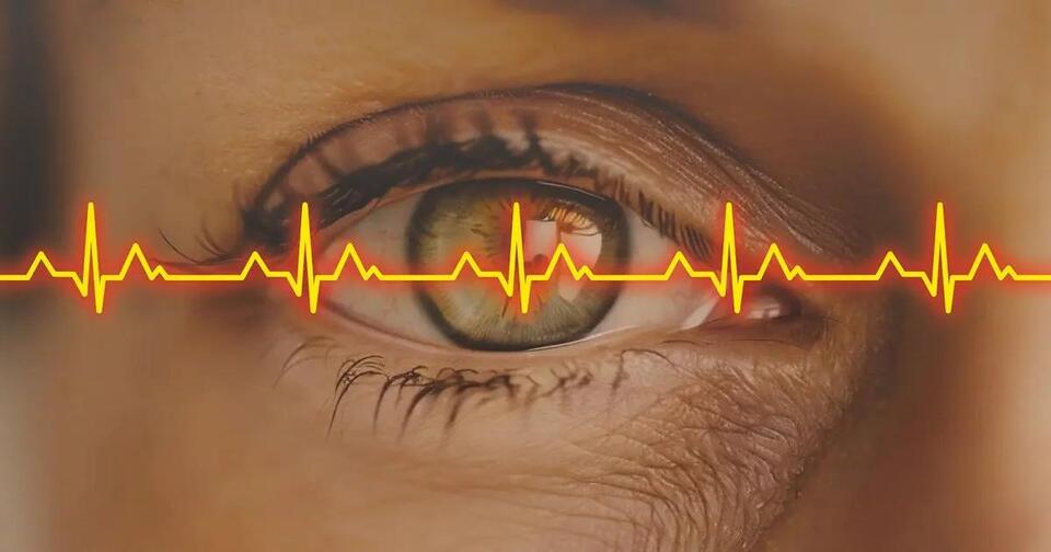 What the eyes reveal: Cardiovascular clues in women—hidden in plain ...