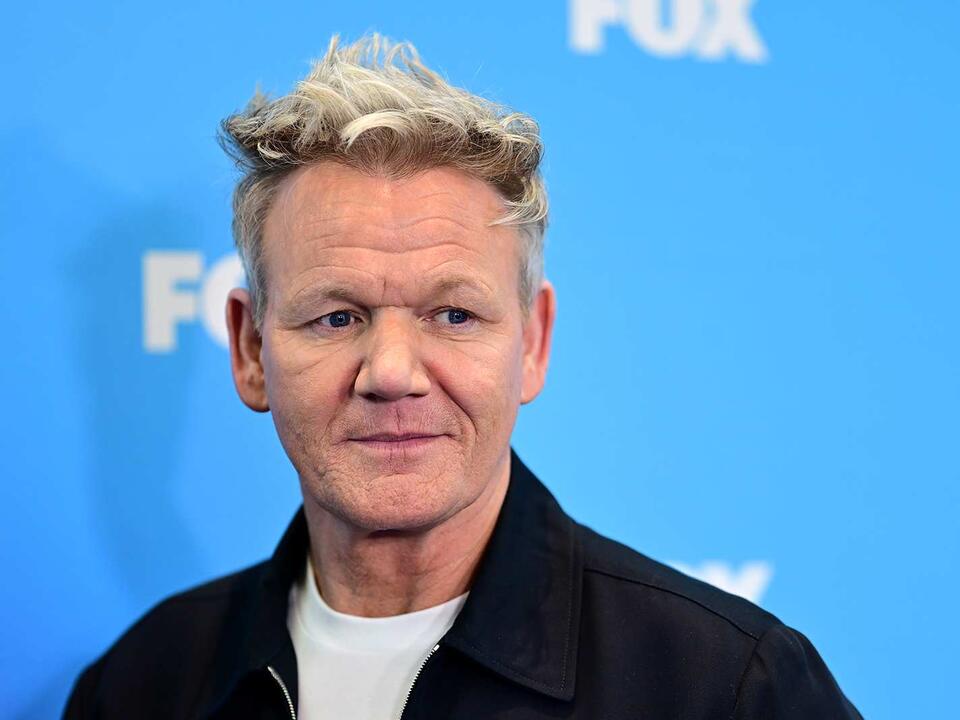 Gordon Ramsay, showing off bruised torso, says he’s ‘lucky to be here ...