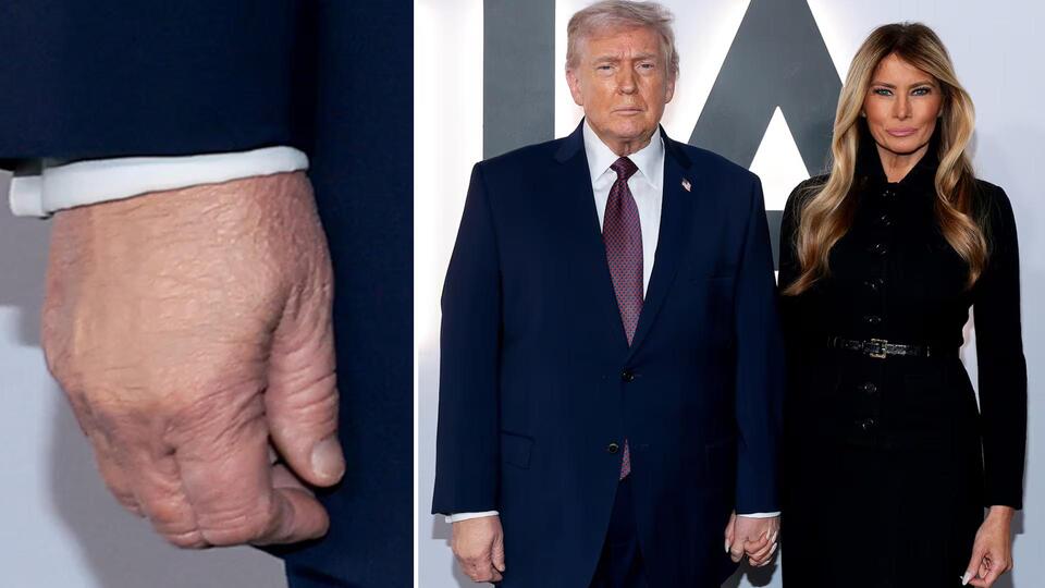 Trump, 79, Coats Hand in Makeup for Melania’s Big Premiere - NewsBreak
