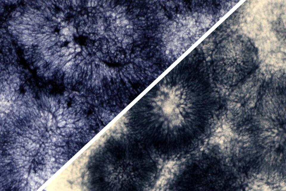 ‘Smooth brain’ disorders may share a common cause — and potential ...