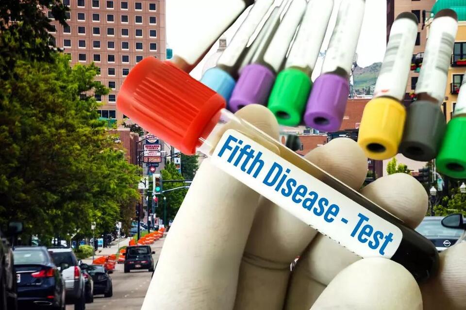 What You Need To Know About The NEW CDC Warning In Idaho - NewsBreak
