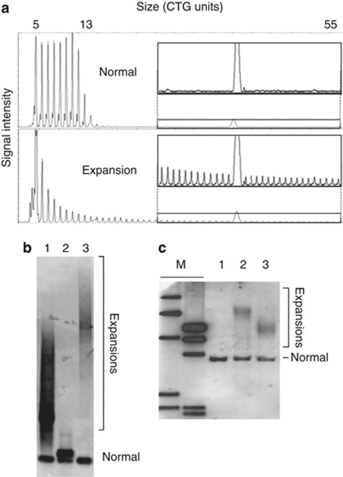 Best practice guidelines and recommendations on the molecular diagnosis ...