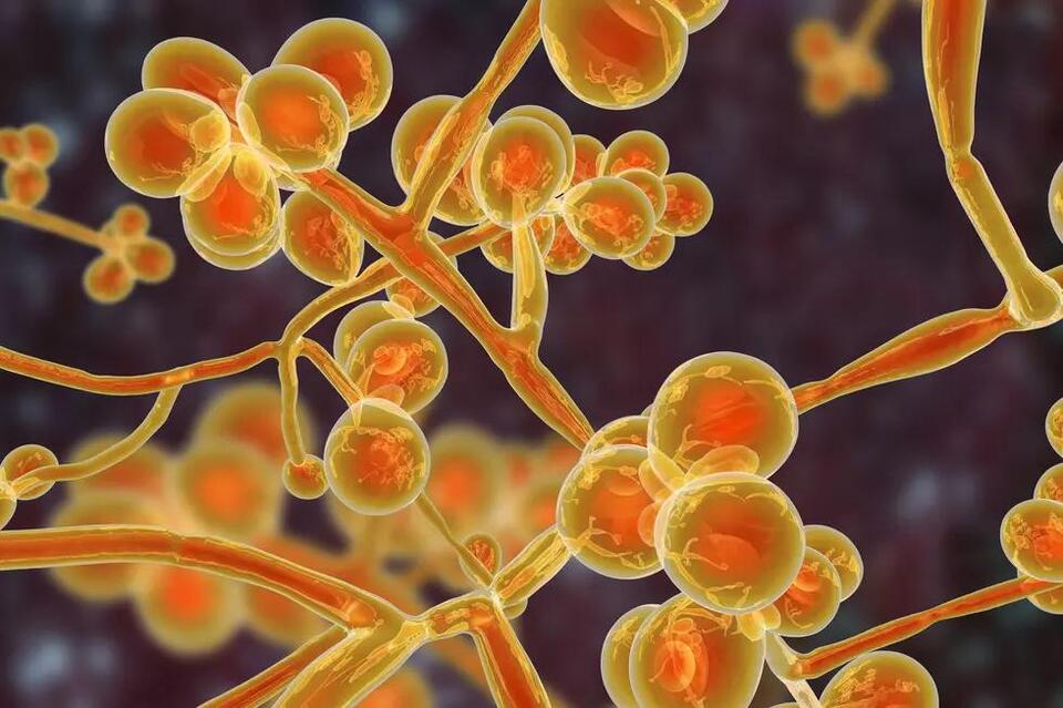 CDC Sounds Alarm As Superbug Killer Surges In New York - NewsBreak