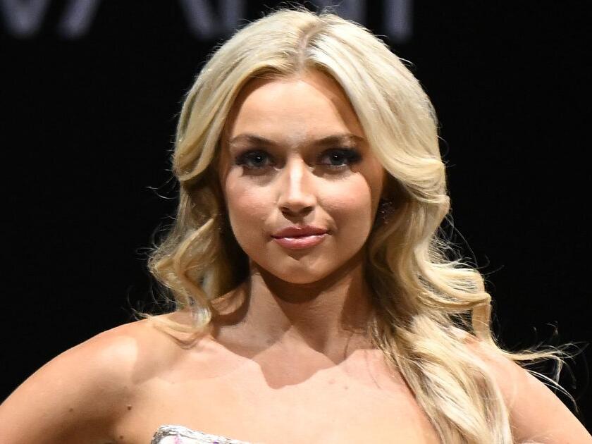 Model Alison Bowles, 28, Says She Used to Be Mocked for Her Moles ...